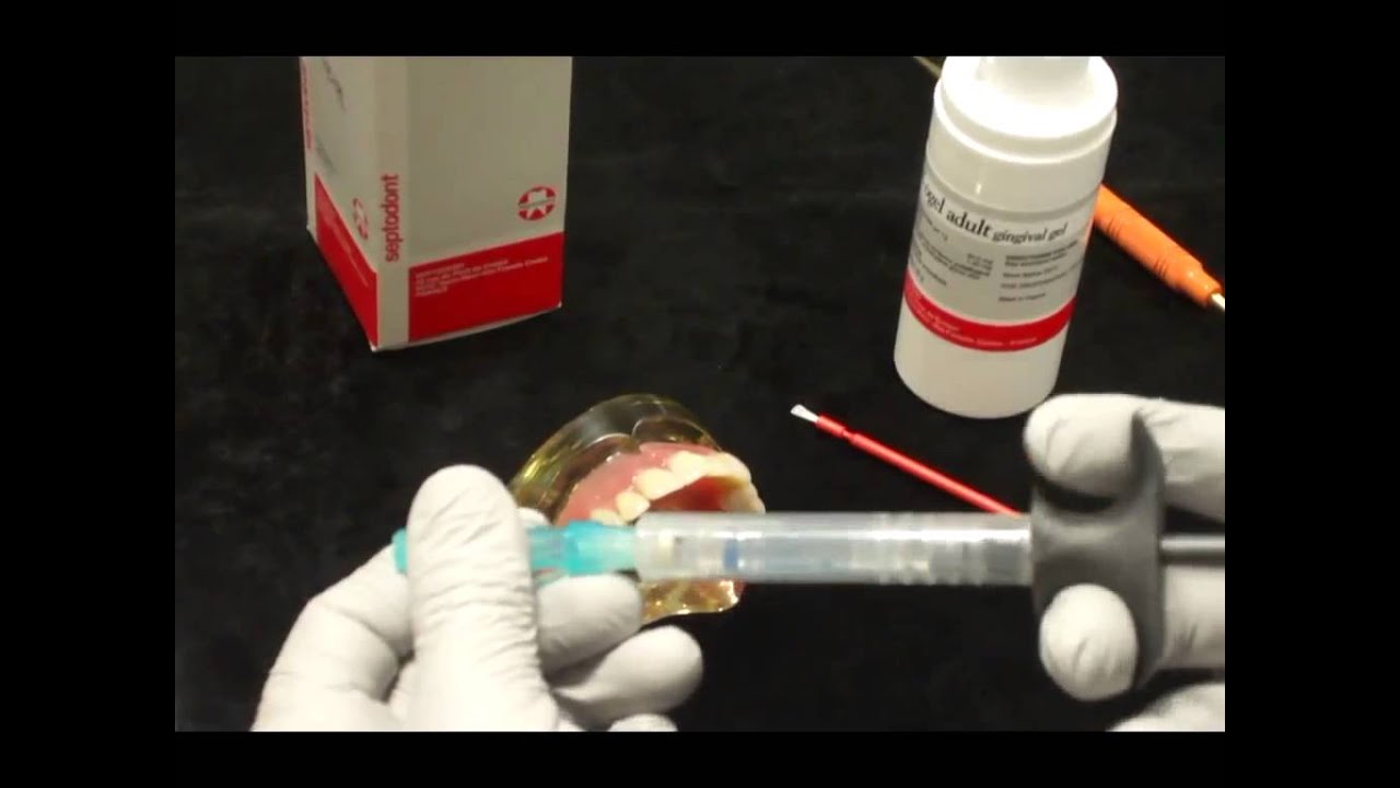 Xogel 국소마취전 도포마취 - YouTube