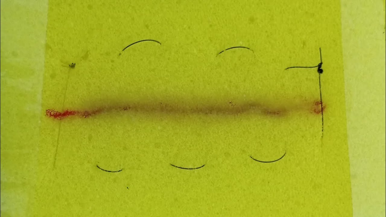 sutura colchoeiro | U deitado contínuo | Técnica Cirúrgica - YouTube