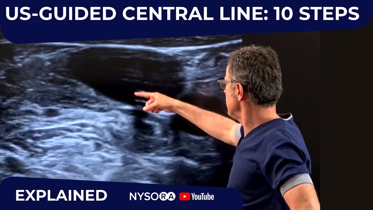 US-Guided Central Line: 10 Steps - Crash course with Dr. Hadzic - YouTube