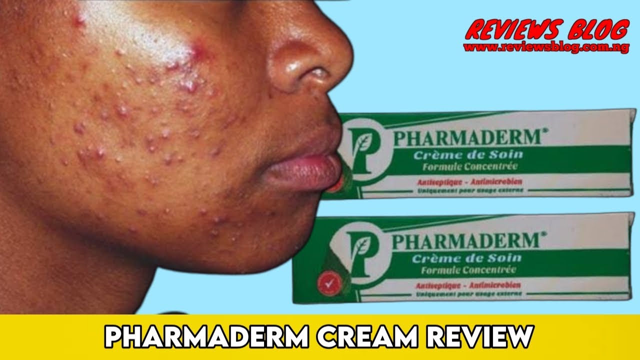 Pharmaderm Cream Review: Watch This Video Before You Buy It - YouTube