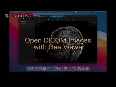 Open DICOM images with Bee Viewer