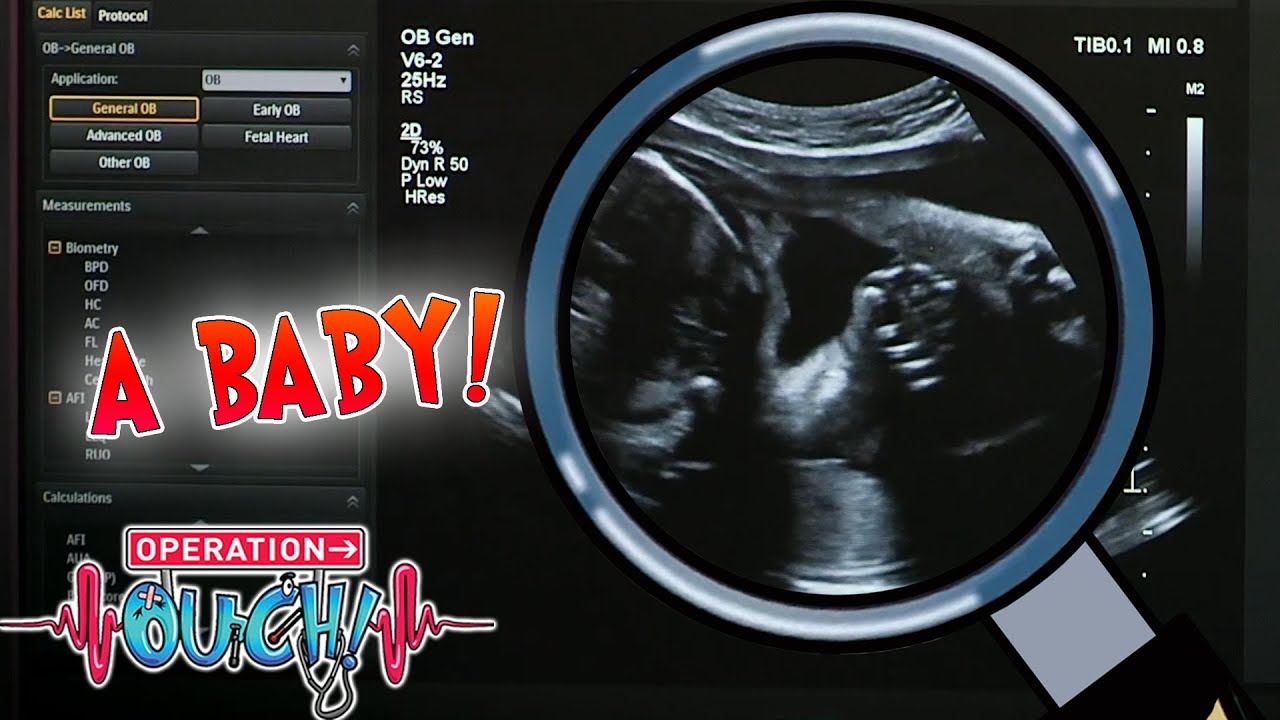 How Does Pregnancy Work? | Full Episodes | Operation Ouch - YouTube