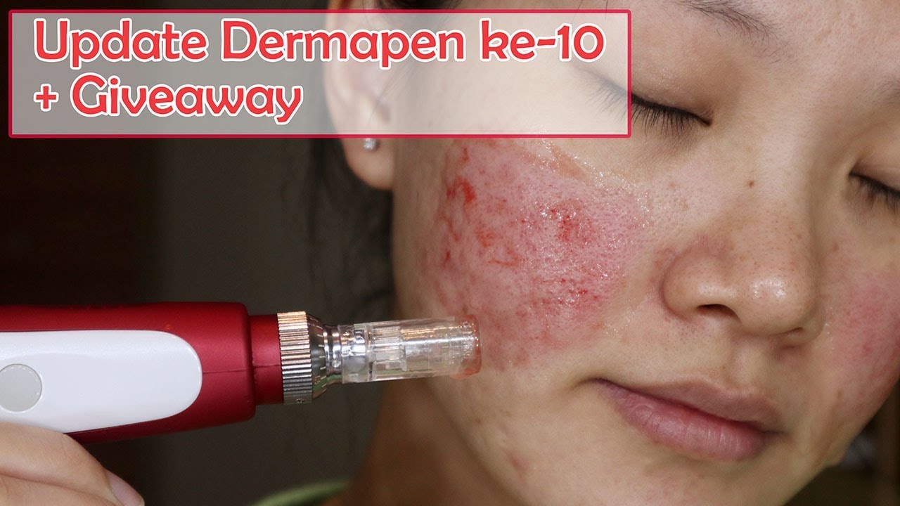 Perawatan Dermapen - Homecare24