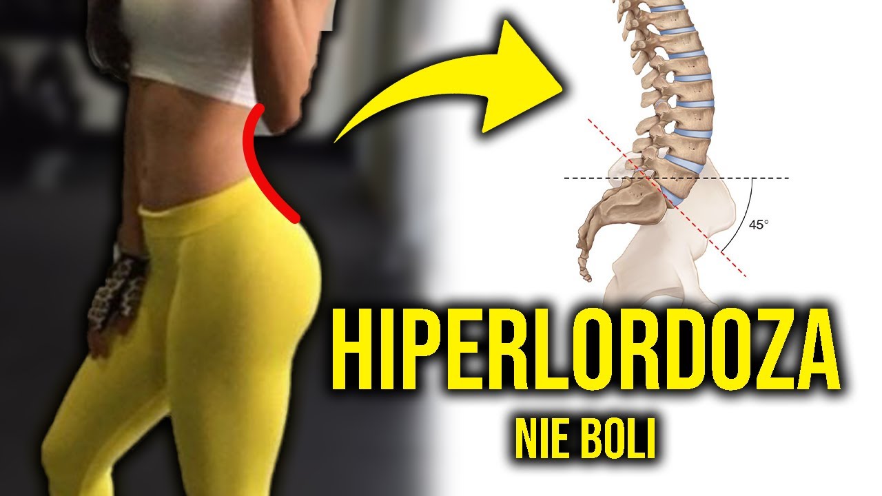 Hiperlordoza, przodopochylenie miednicy - a BÓL LĘDŹWI *wystający ...