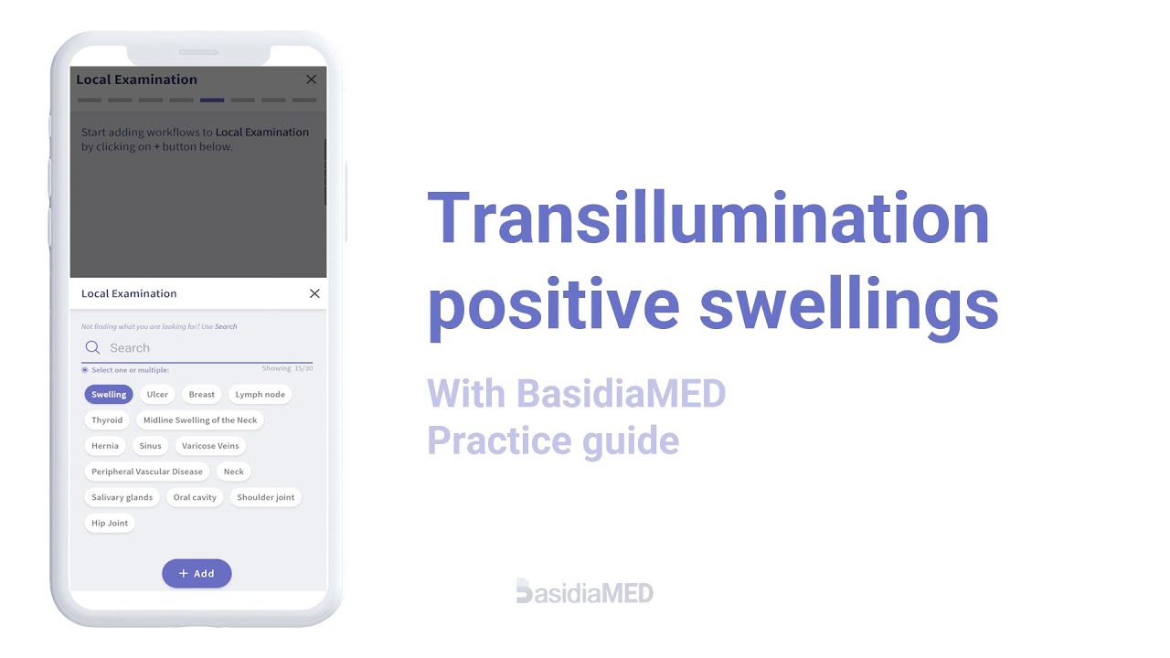 Transillumination Positive Swellings | BasidiaMED Practice - YouTube