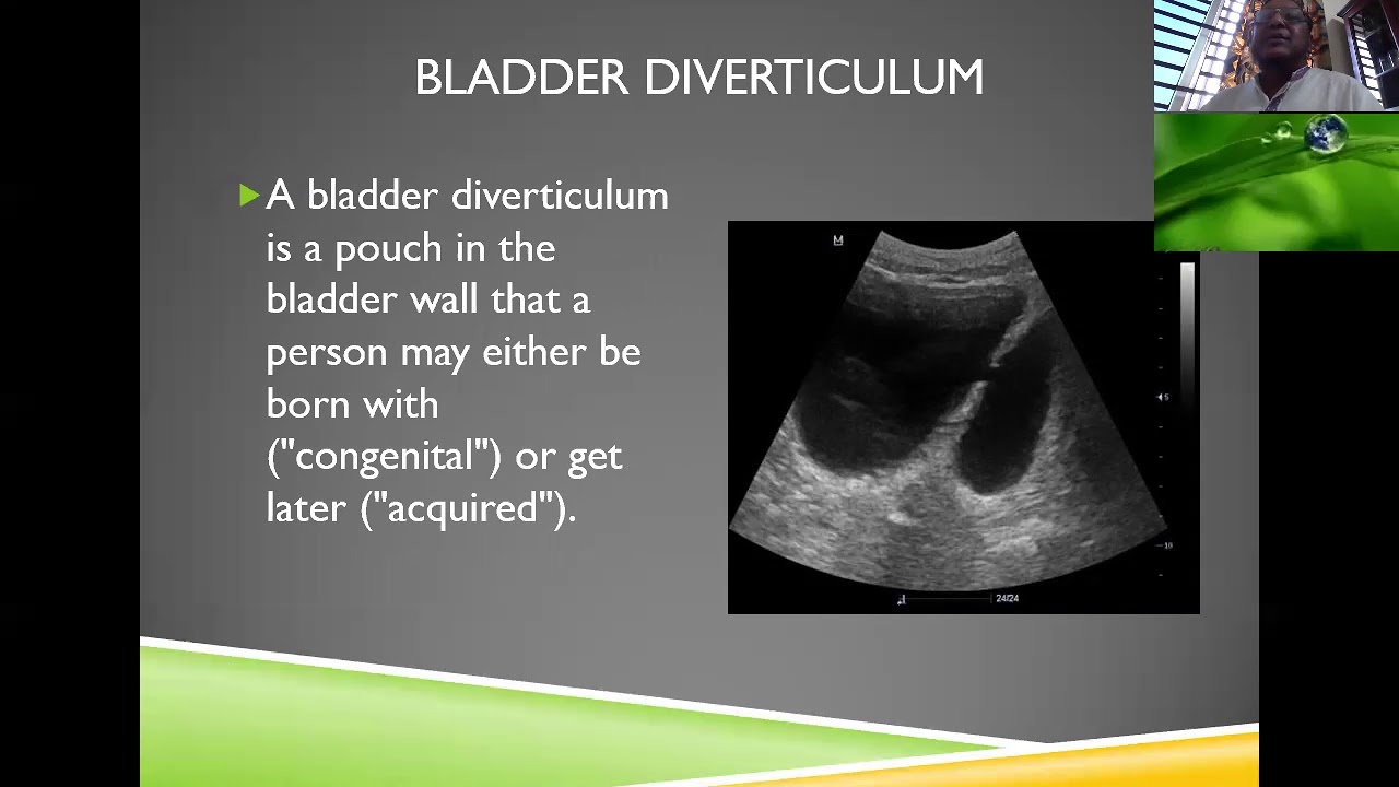 Ultrasound of Normal & Abnormal Urinary Bladder Adult & Fetal - YouTube