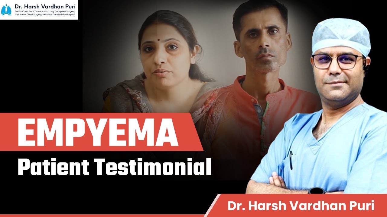 Empyema Patient Testimonial | Empyema Diagnosis and VATS Surgery | Dr ...