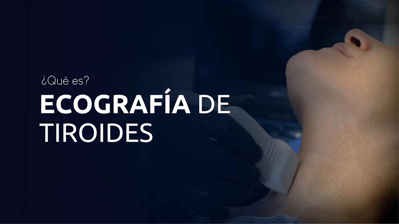 Ecografía de Tiroides I Ecografía de Tiroides en Medellín I Ecografía ...