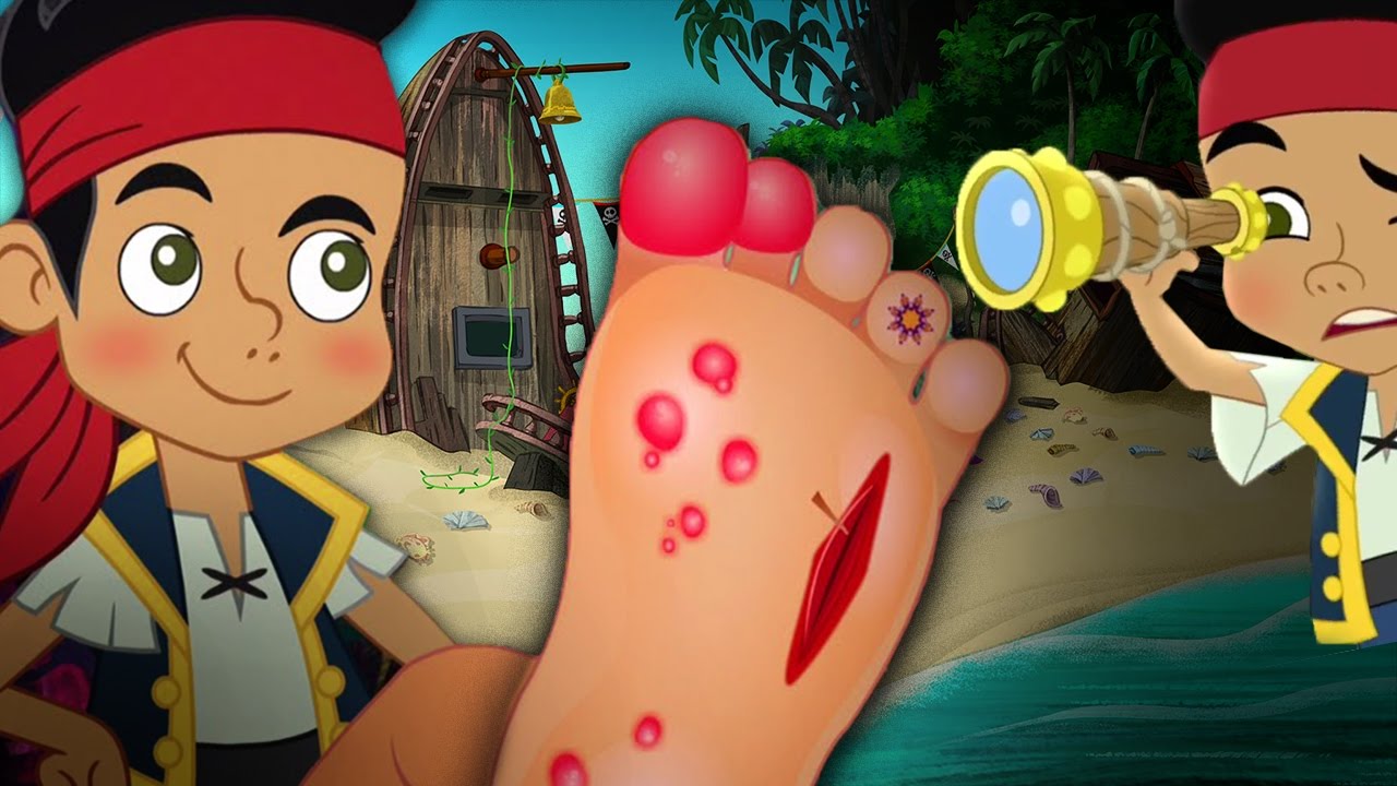 Jake Foot Doctor | Jake and the Neverland Pirates online game for kids ...