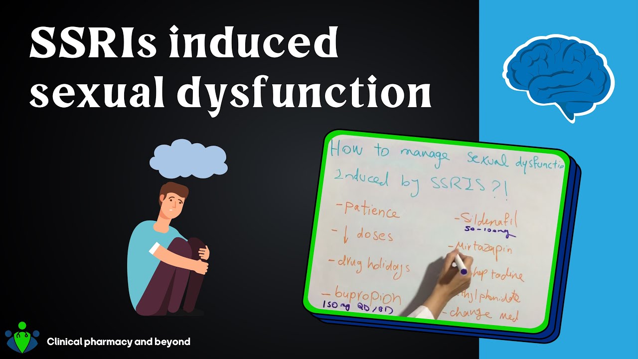 How To Manage Sexual Dysfunction Induced By Antidepressants Youtube
