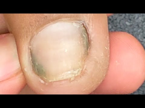 DIRT UNDER NAIL AND DEEP CLEAN IT. - YouTube