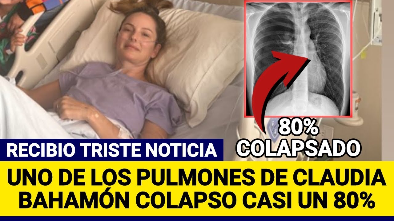 Claudia Bahamón: Su pulmón colapso en un 80% y recibió una triste ...