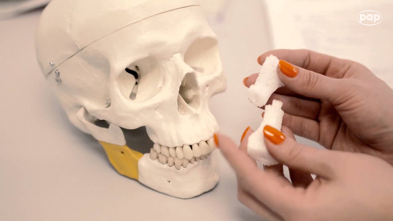 Bioimplant - YouTube