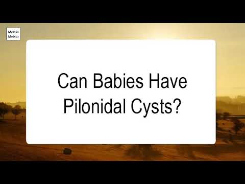 Can Babies Have Pilonidal Cysts - YouTube