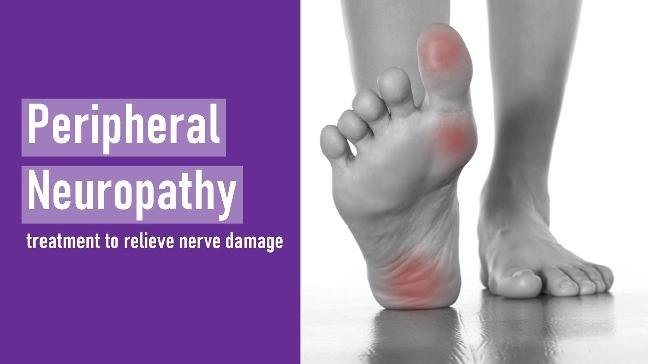 Peripheral neuropathy - symptoms and signs, causes, pathophysiology ...