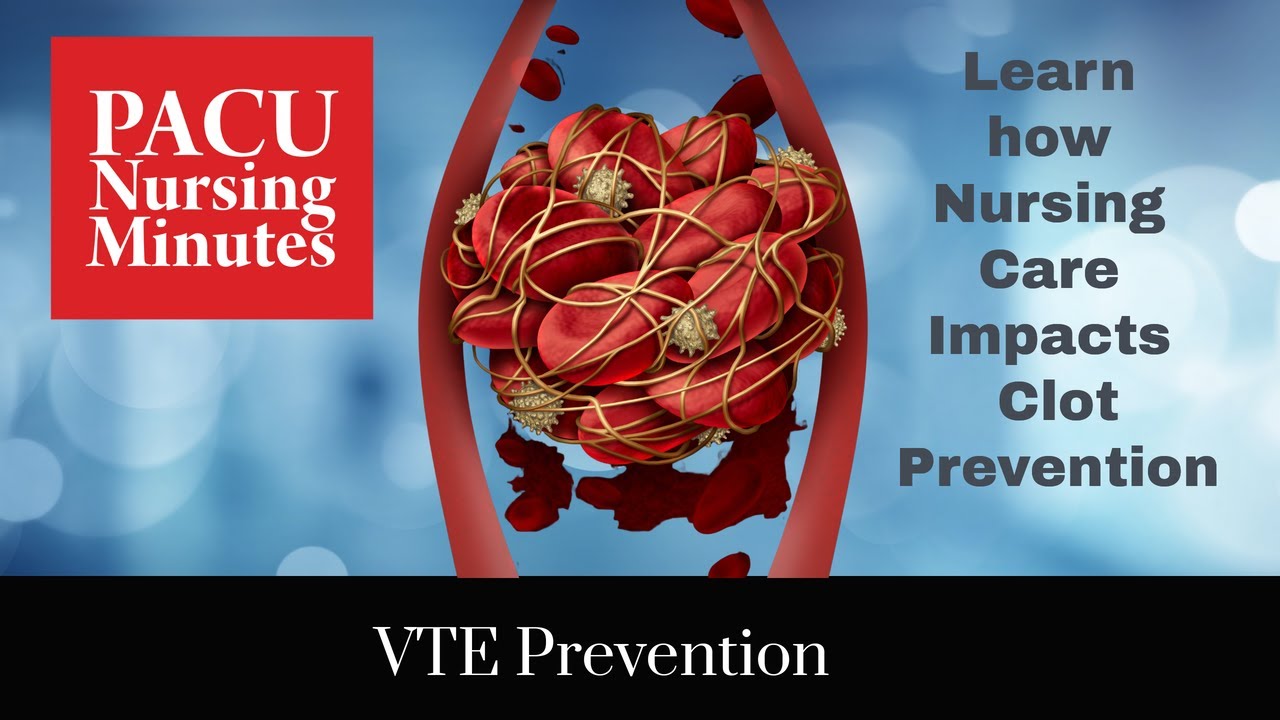 VTE Prevention, How Nursing Care impacts clot prevention. - YouTube