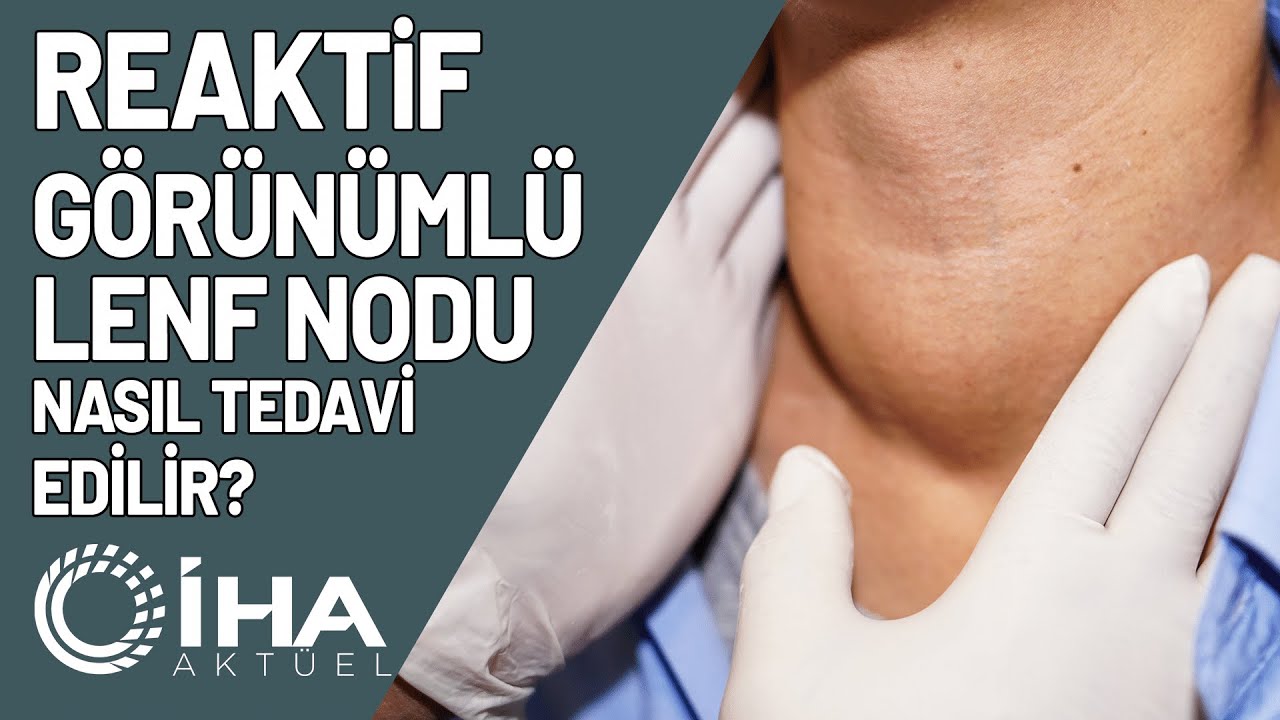 Reaktif Görünümlü Lenf Nodu Nasıl Tedavi Edilir - YouTube