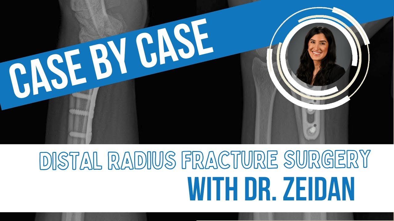 Distal Radius Fracture Surgery: Dr. Zeidan's Case Study & Recovery ...