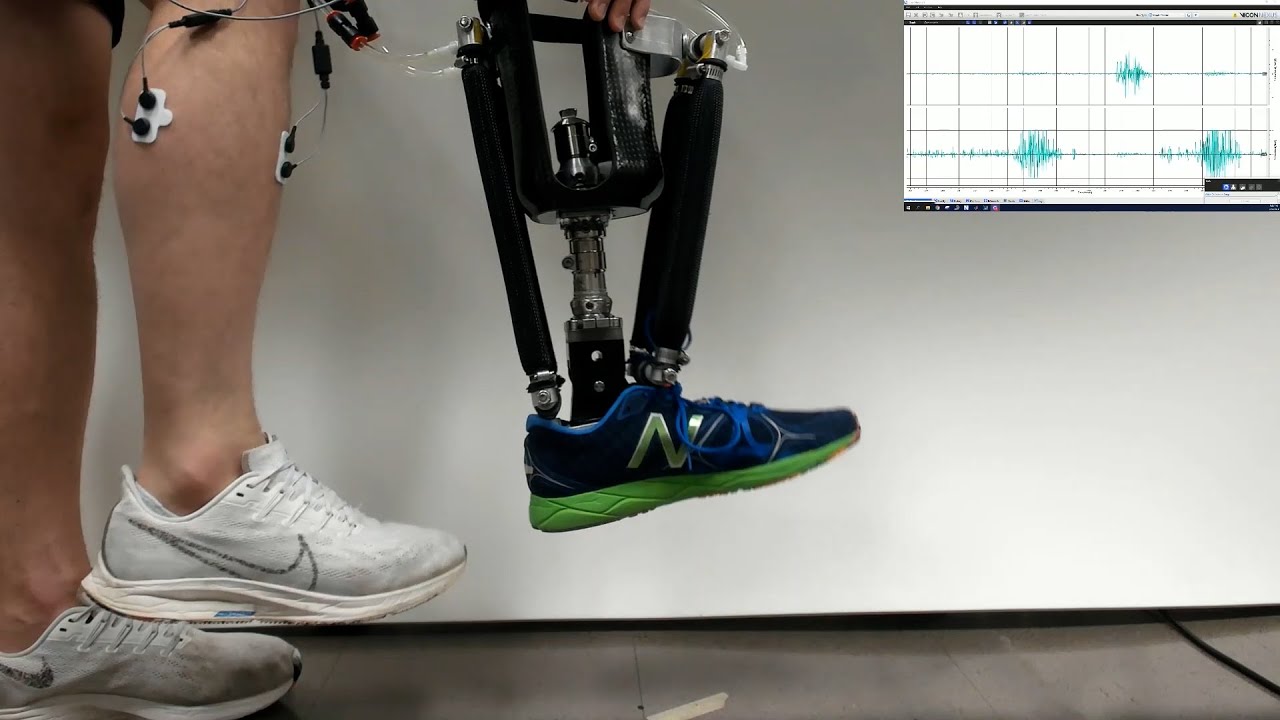 Prosthetic uses brain signals to help with balance and stability - YouTube