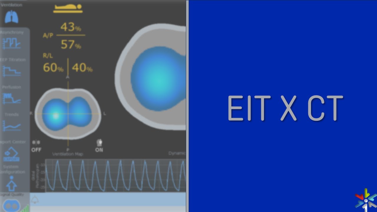 EIT vs CT - YouTube