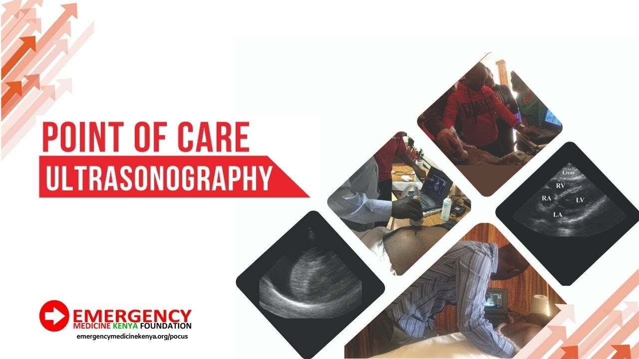 FAST - RUQ Exam - Positive - YouTube