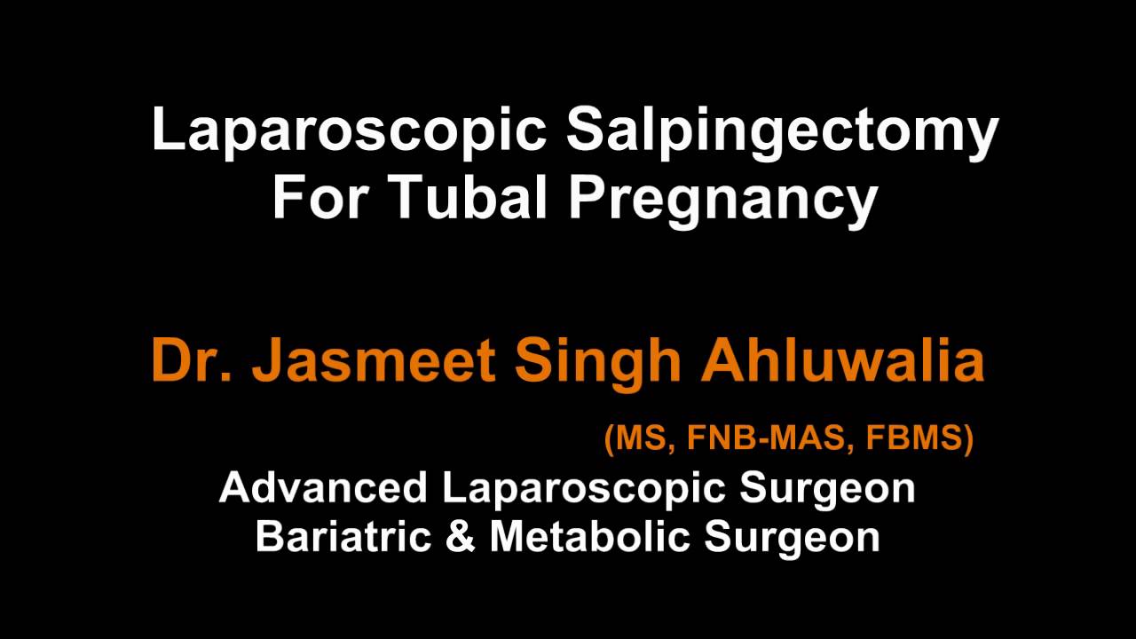 Laparoscopic Salpingectomy | Ectopic Pregnancy | Dr. Jasmeet Ahluwalia ...