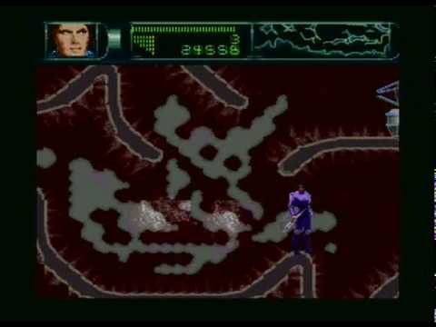 Rex Ronan: Experimental Surgeon - SNES - YouTube