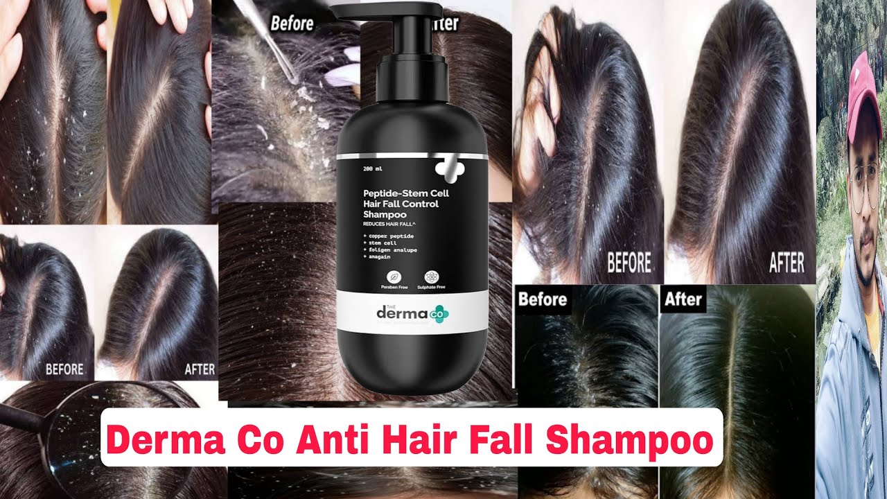 Derma Co Anti Hair Fall Shampoo Review - YouTube