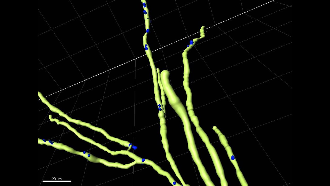 Imaris: Traced Neuron - Ben Sivyer (Williams Lab) - YouTube