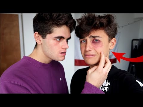 I GOT BEAT UP PRANK ON BOYFRIEND (Gay Couple Edition)
