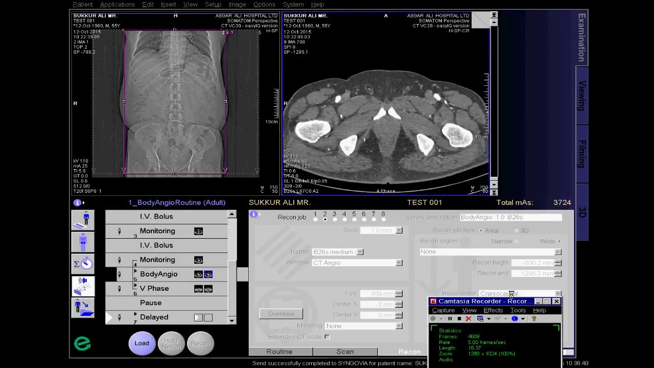CT Abdominal angio Full Work Process (SIEMENS) in syngo acquisition ...