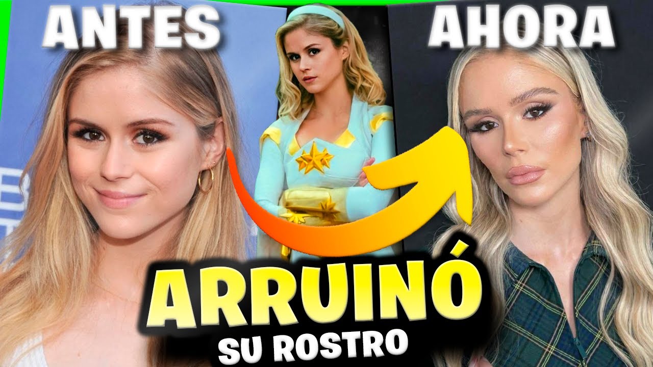 😳 Actriz de The Boys ARRUINÓ su rostro con CIRUGÍA PLÁSTICA 😳 Erin ...
