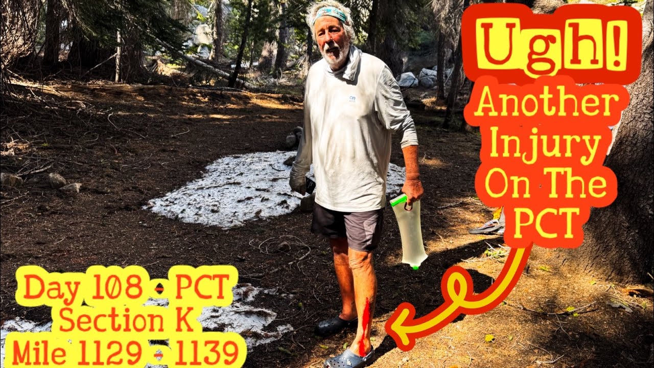 Day 108 - PCT - Ugh! Another Injury On The PCT - YouTube
