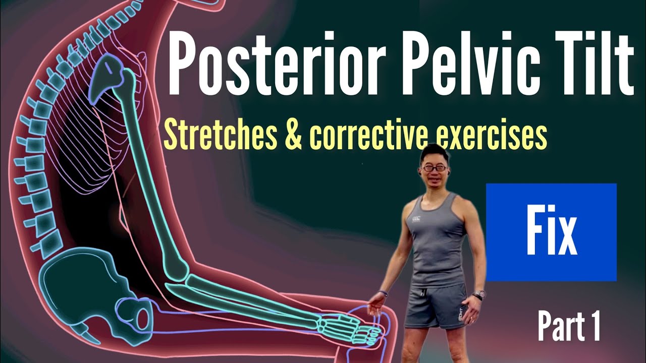 Posterior pelvic tilt | Posterior Pelvic tilt stretches & corrective ...