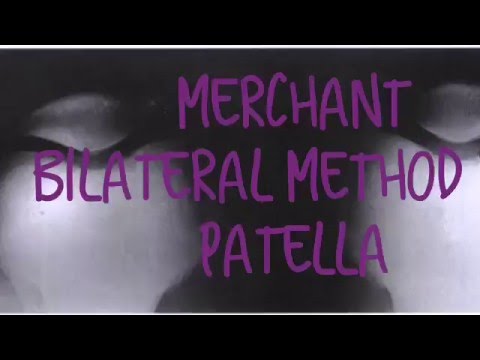 Merchant Method: Patella - YouTube