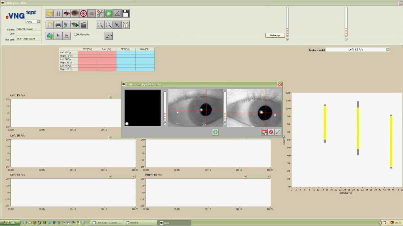 eVNG Optokinetic Test - YouTube