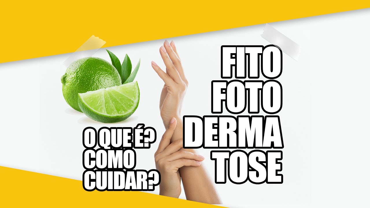 Fitofotodermatose: o que é? Como cuidar? - YouTube
