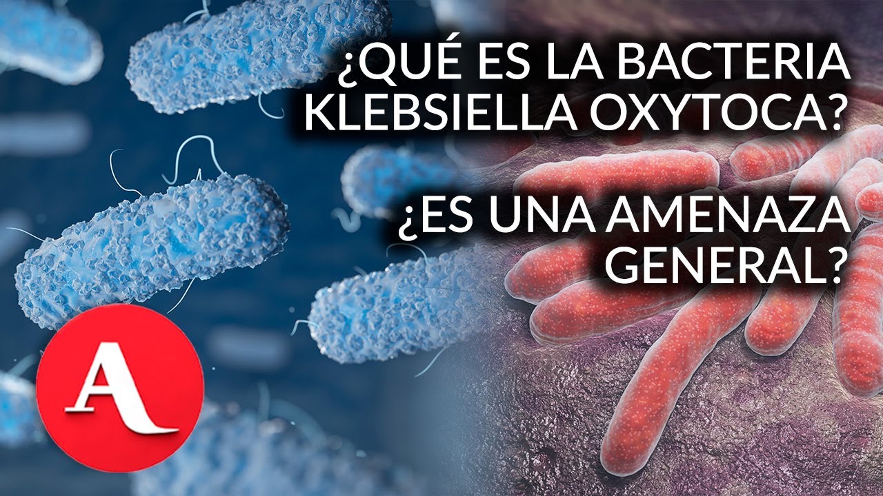 Casos de bacteria Klebsiella oxytoca no representan una alerta para ...