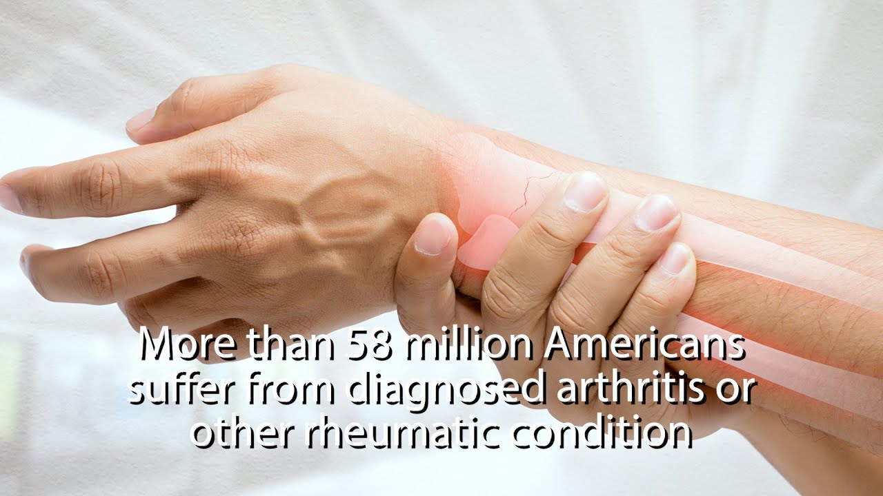 DR ASFAR RELIEF ARTHRITIS TESTIMONIES 11623 - YouTube