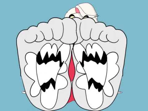 Charlie Foot Growth (Hazbin Hotel)