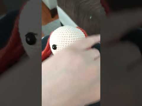 melodi bebek saç ekimi