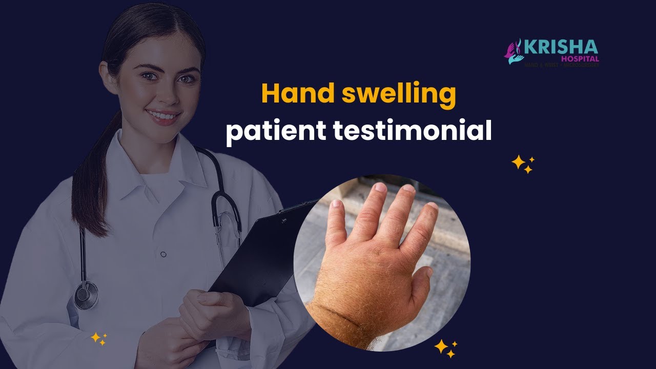 Patient Testimonial: Hand Swelling surgery performed by Dr. Karn ...