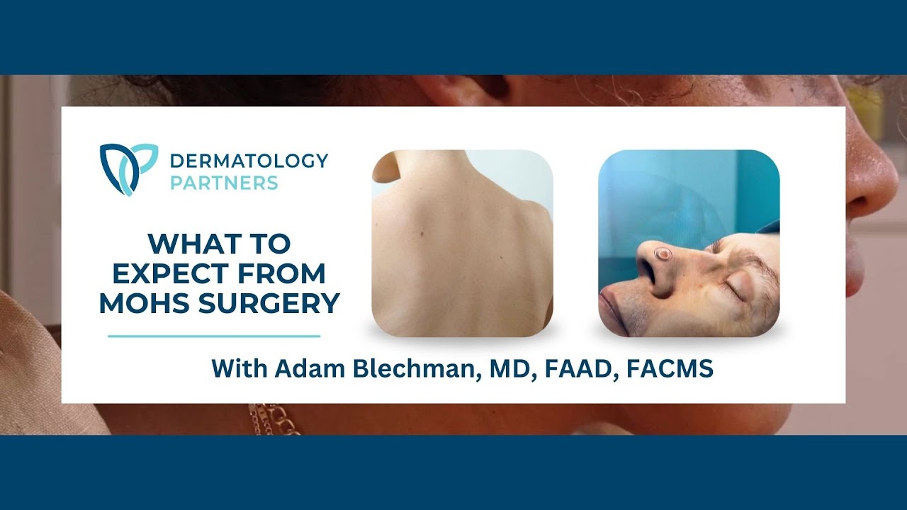 What to Expect from Mohs Surgery with Adam Blechman, MD, FAAD, FACMS ...