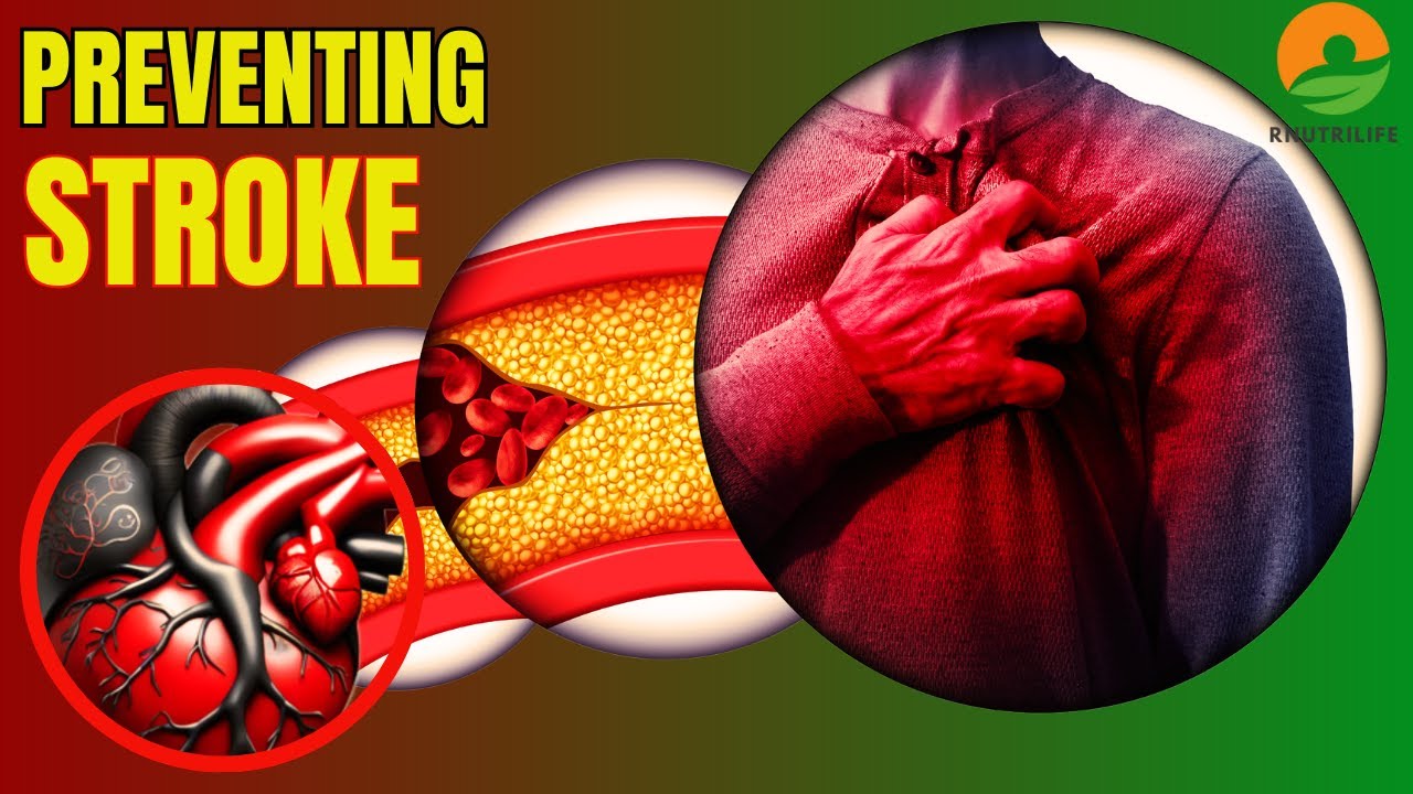 How to Save Your Life by Preventing Strokes! - YouTube