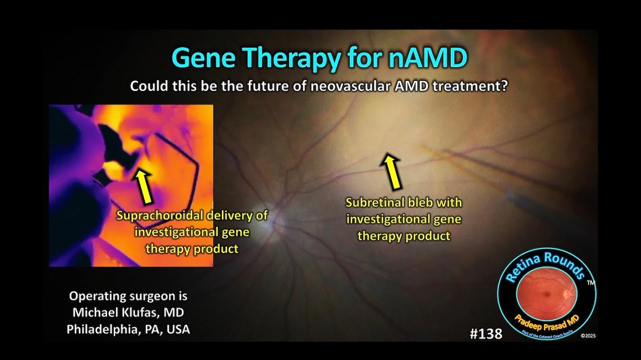 RetinaRounds™ 138: Gene Therapy for nAMD - YouTube