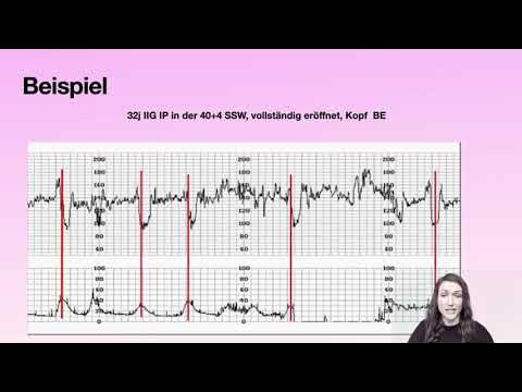 CTG Beispiele - YouTube