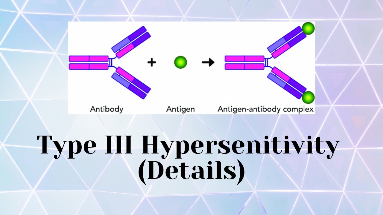 Type III Hypersensitivity (Details) - YouTube