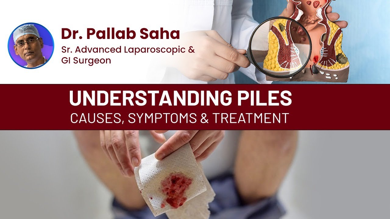 কলকাতায় সেরা পাইলস ট্রিটমেন্ট | Best Piles Treatment in Kolkata ...
