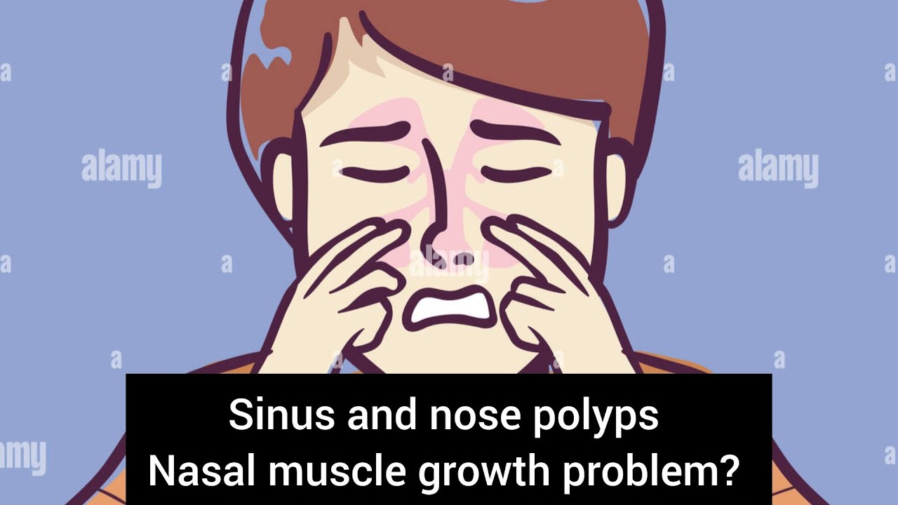 Sinuses and nasal polyps problem video |sudharsan kriya| nose massage ...