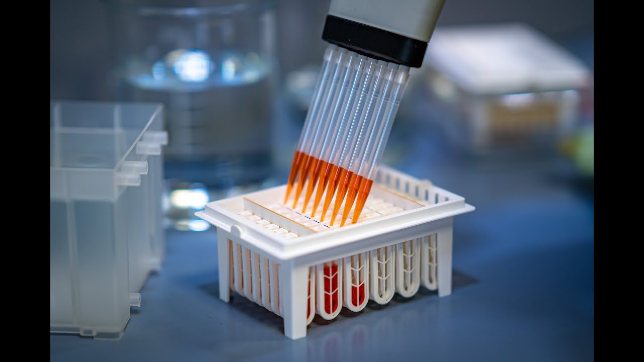 XDB - Xpress Dialysis Box Handling scienova GmbH - YouTube